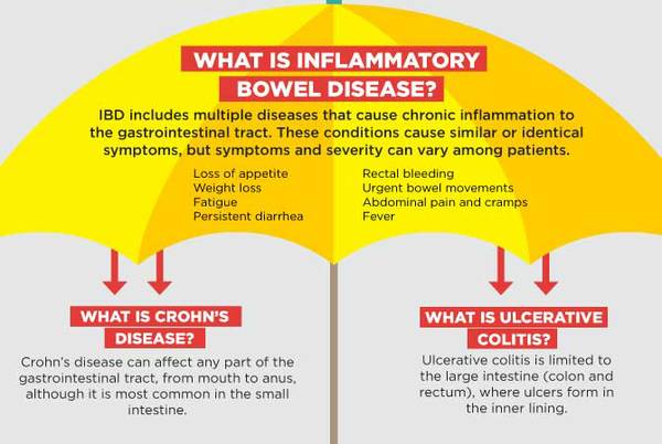 Ulcerative Colitis Symptoms Ibd Prevalence Impact Causes